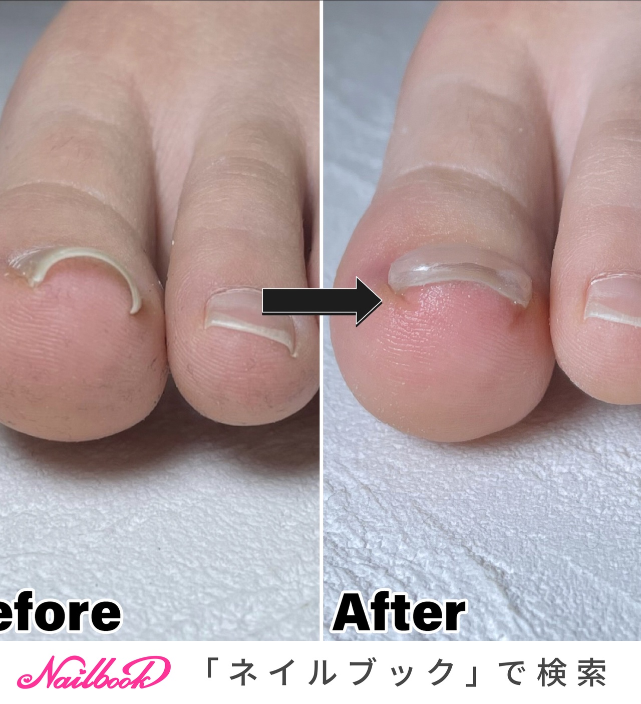 フット/お客様 - T.Yukaのネイルデザイン[No.8157279]｜ネイルブック